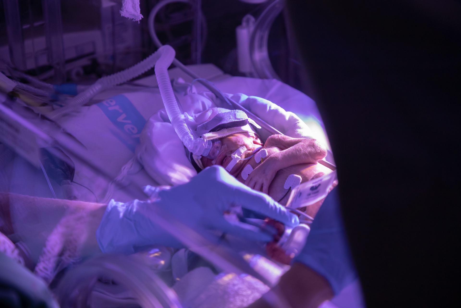 Fotogalería: UCI de Neonatología, donde los milagros suceden cada día