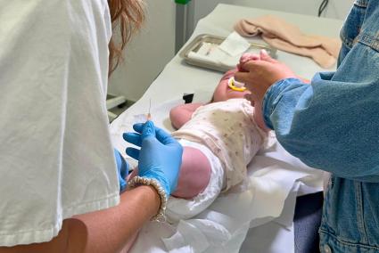 Salud: Bajan a la mitad los casos de paperas en Baleares