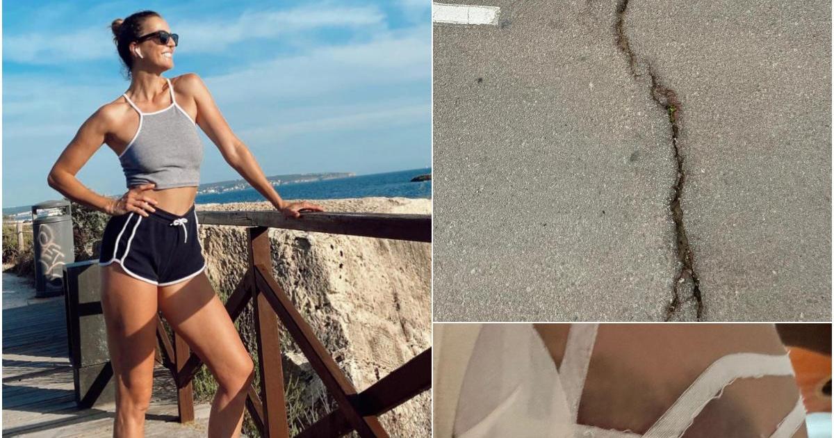 Carril bici de Palma | Maria Rossich sufre una grave fractura al caerse